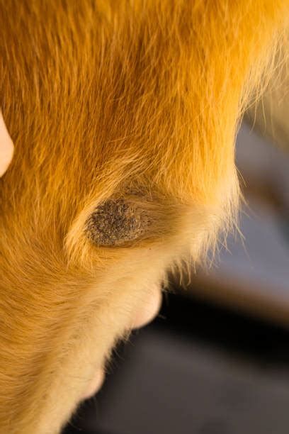 190 Ulkus Dekubitus Foto Foto Foto Stok Potret And Gambar Bebas