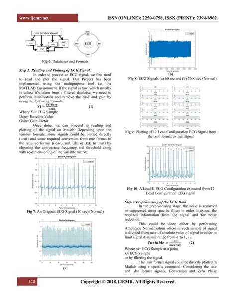 Classification Of Arrhythmia From Ecg Signals Using Matlab Pdf Heart And Cardiovascular