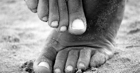 Do You Have Tiny Holes In The Skin On The Soles Of Your Feet