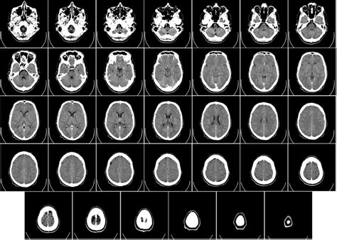 Brain Structure And Function A Level — The Science Sauce