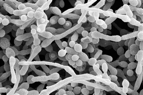 Les 5 Meilleurs Suppléments Pour Le Traitement De La Candidose Drsoleil