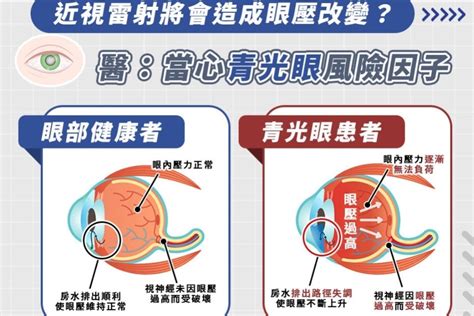 近視高眼壓易青光眼恐失明 青光眼手術年輕化警訊 自行停藥更危險四季線上4gTV
