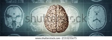 Wall Paper Ct Scan Images Stock Photos D Objects Vectors Shutterstock