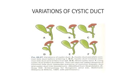Cholecystectomy Anatomy Types Surgical Steps Errors Troubleshooting Complications And