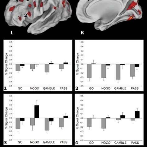 Overview Of Clusters Showing More Deactivation In The Adolescents Of