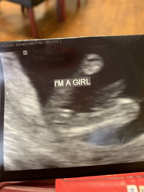 Babe Or Girl Ultrasound Wrong Gender Scan Accuracy