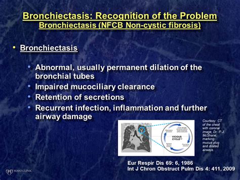 Definition Bronchiectasis Emerging Trends And Unmet Needs Bronchiectasis Best Practice And