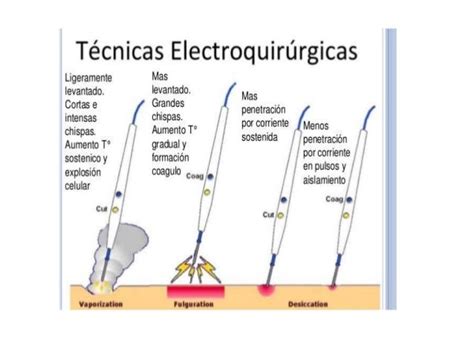 Electrocoagulacion Y Electrocirugia