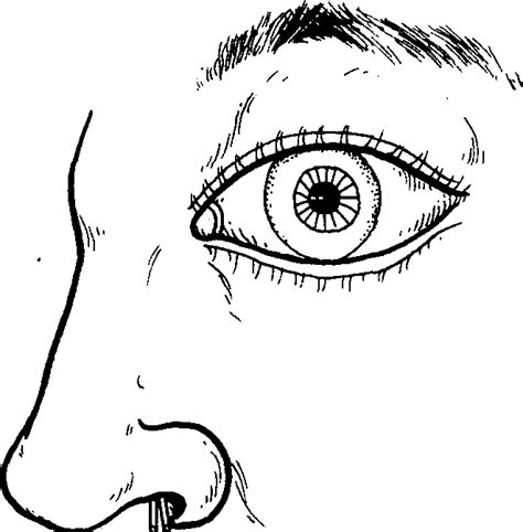 5 泪道插管术 眼科手术