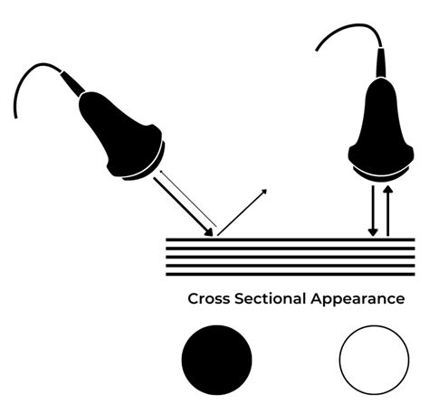 Us Probe An Abundance Of Artifacts Emdocs