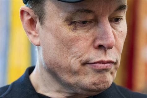 Mata Lebam Elon Musk Dan Perpisahan Dengan Pemerintahan Trump