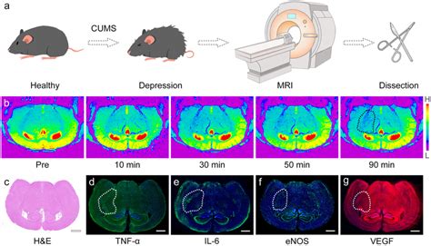 In Vivo Inflammation Mapping Of The Depressed Brain With Mri A