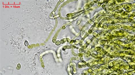 Cyanobacterianostocalessymphyonemataceaebrachytrichiasp