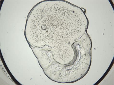Protein Crystallization Automation And Software Formulatrix®