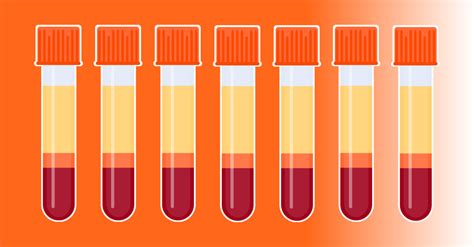navigate the challenges of large scale plasma proteomics