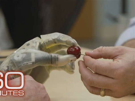 How Advancements In Prosthetic Technology Allow Feeling Control 60