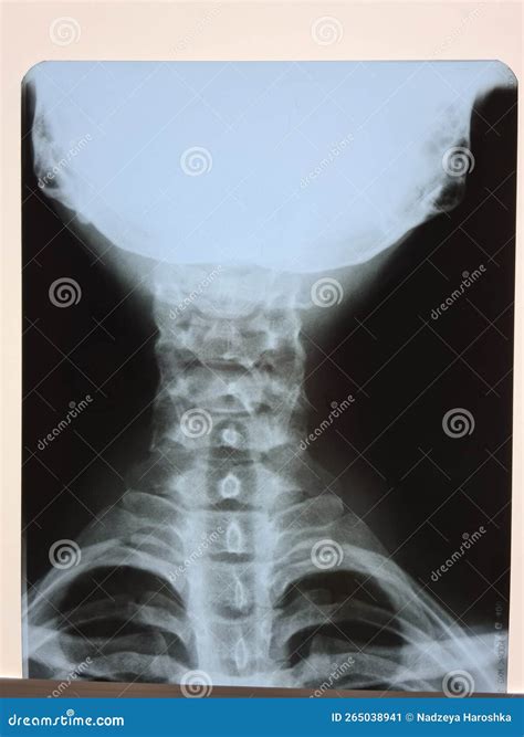 X Ray Image Of Human Spine And Pelvic Stock Photography Cartoondealer Com