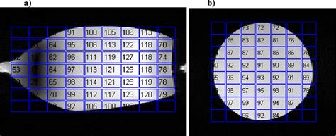 Pdf High Frequency Transmit Receive Phased Array Coil For Head And Neck Mr Neuroimaging At 3