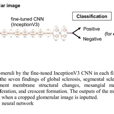 Performance Of Glomerular Classification For Seven Findings On Pas Staining Download
