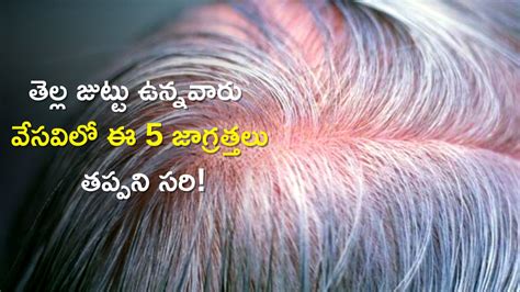 White Hair Treatment In Summer Season White Hair And Hair Loss Persons