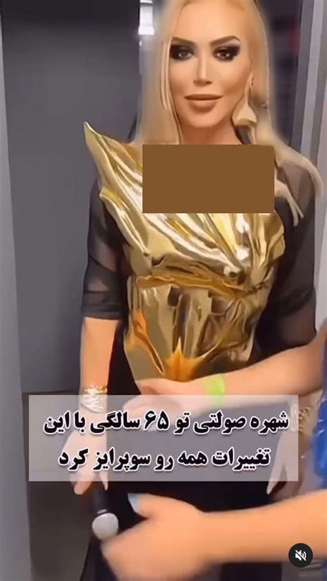 تغییرات شهره صولتی در 65 سالگی عکس های قبل از عملش را دیده اید؟