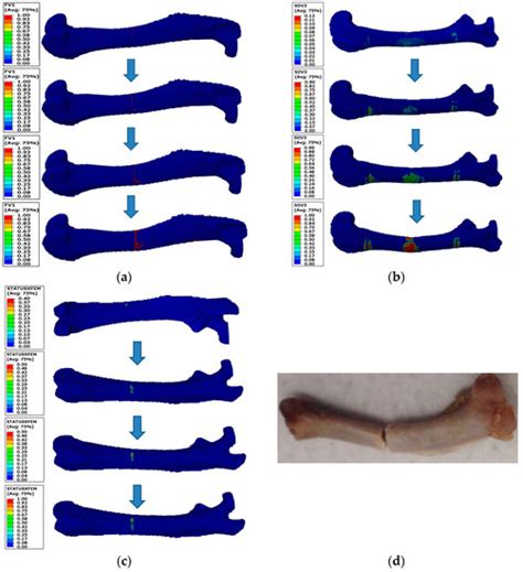 Effects Of Different Numerical Methods On The Fracture Prediction Accuracy For Cortical Bone