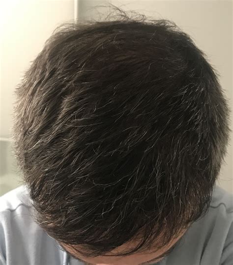 A6 D81 B7 F 9 Aee 4 F67 8 A07 E429 D1 C00 Ce9 — Postimages