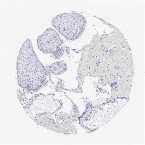 Tissue Expression Of Slc1a2 Staining In Placenta The Human Protein Atlas