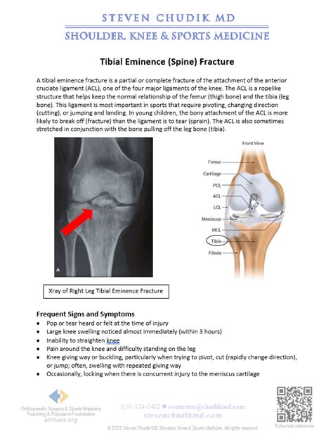 Intercondylar Eminence Of Tibia