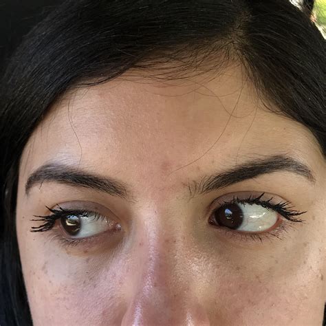 Skin Concerns Congested Skin Rskincareaddiction