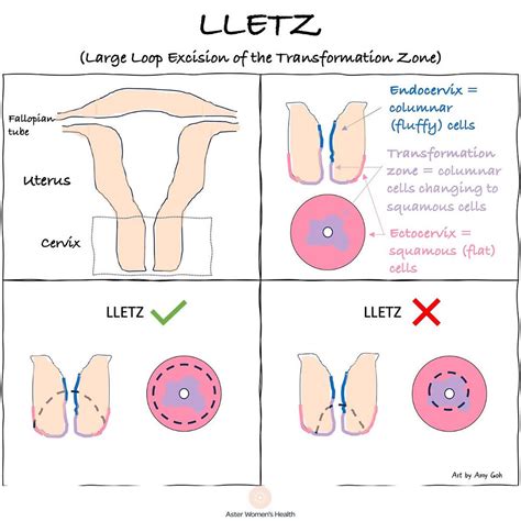 Lets Talk Lletz
