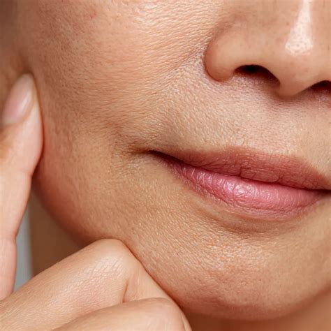 What Helps Crepey Skin Causes And Treatments Explained