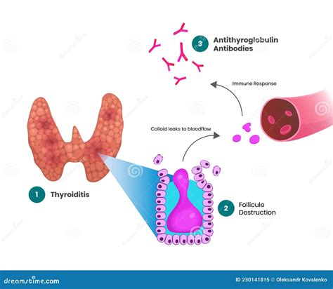 Thyroglobulin Cartoons Illustrations And Vector Stock Images 42 Pictures To Download From