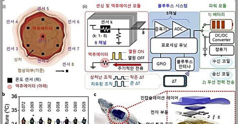 Kaist 상처 추적 뒤 사라지는 스마트 헬스케어기기 개발