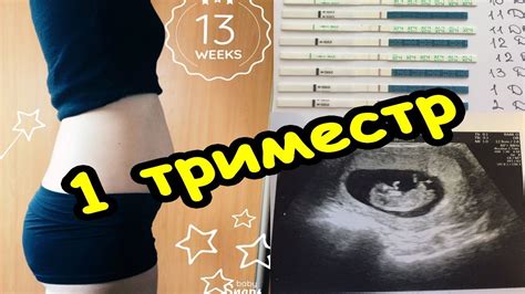 МОЯ БЕРЕМЕННОСТЬ ДВОЙНЕЙ БЕСПЛАТНАЯ МЕДИЦИНА ПО ОМС 1 ТРИМЕСТР Youtube