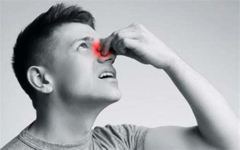 Sinusitis Nose And Ear And Health Article Article No 2788