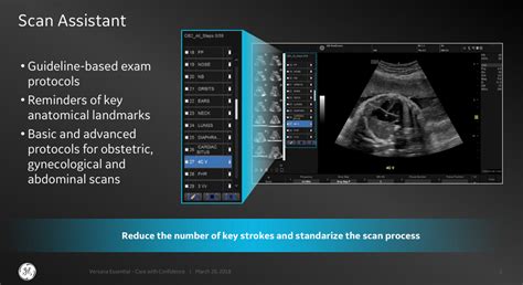 Ge Versana Club Scan Assistant