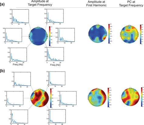 Topographic Maps Presenting The Peak Amplitude Of The Auditory Download Scientific Diagram