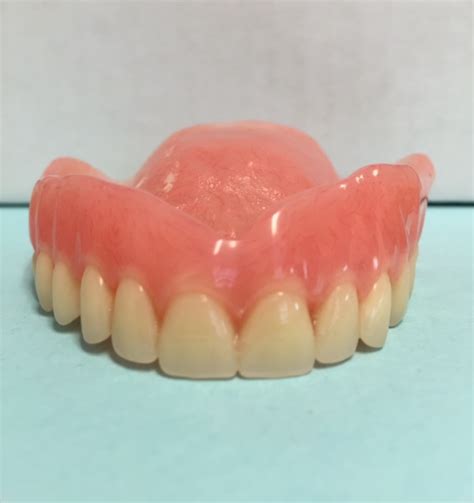 Complete Upper Denture Case Dr Gentry