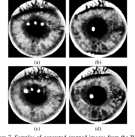 Figure 7 From Identity Preserving Gan For Cross Spectral Iris Recognition Semantic Scholar