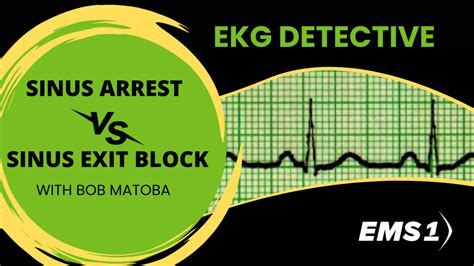 Ekg Detective Sinus Arrest Vs Sinus Exit Block