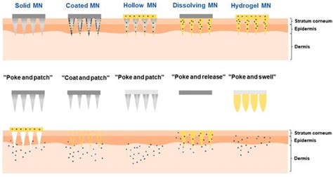 The Necessity To Investigate In Vivo Fate Of Nanoparticle Loaded Dissolving Microneedles