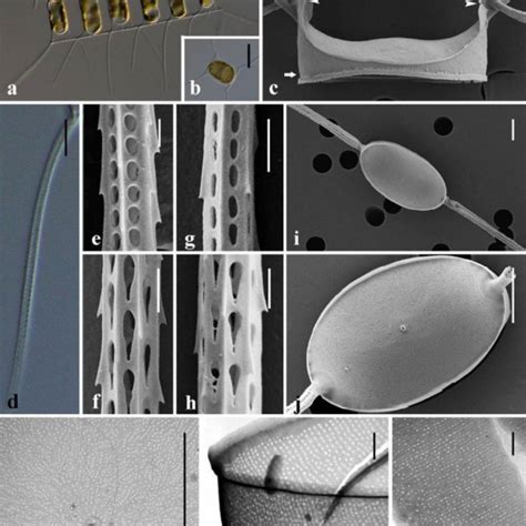 Lm Abd Sem Ce J And Tem K M Micrographs Of Vegetative Cells
