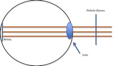What Are Pinhole Glasses Natural Vision Hq