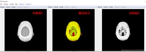 matlab医学三维重建可视化库 matlab超声曲面voi设计三维重建 csdn博客