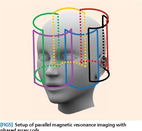 Figure 1 From Parallel Mri Using Phased Array Coils Semantic Scholar