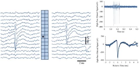 Figure 12 From Close Packed Silicon Microelectrodes For Scalable Spatially Oversampled Neural
