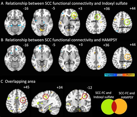 Resting State Functional Connectivity Of Subcallosal Cingulate Cortex Download Scientific