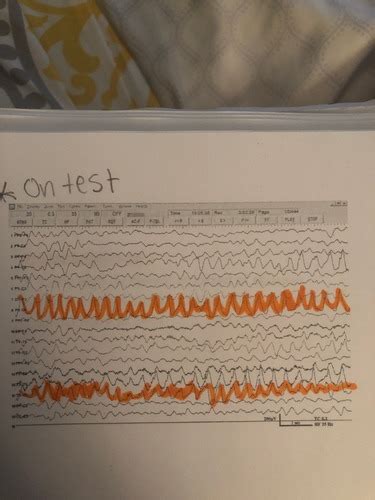 EEG Midterm Flashcards Quizlet