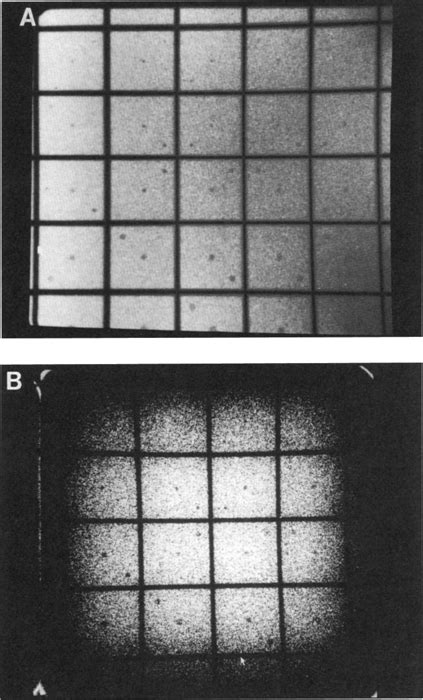 Portion Of Cdmam Phantom Imaged With System Two Using Two Plates 27